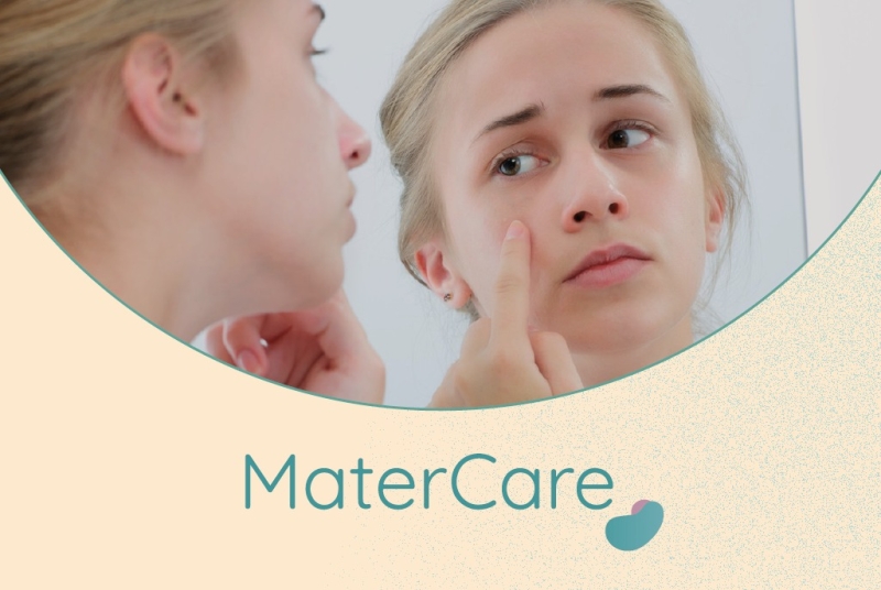 Novedades MaterCare - MaterCell - Banco de células madre